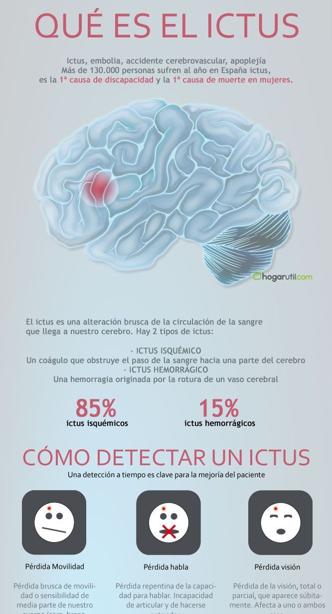 El ictus cerebral. Síntomas y prevención. | Infografías y Remedios