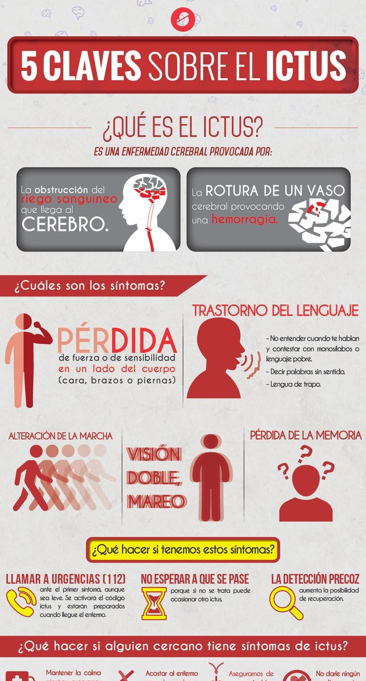 5 claves para reconocer un ictus